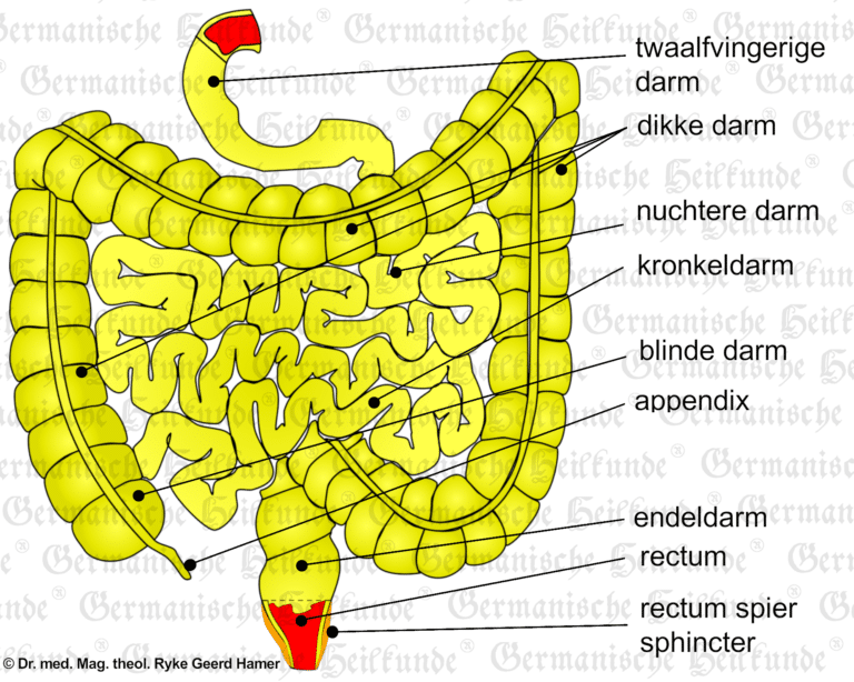Kronkeldarmkanker - Germanische Heilkunde